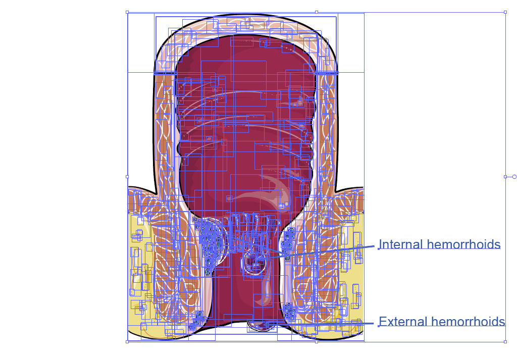 Hemorrhoids Vector